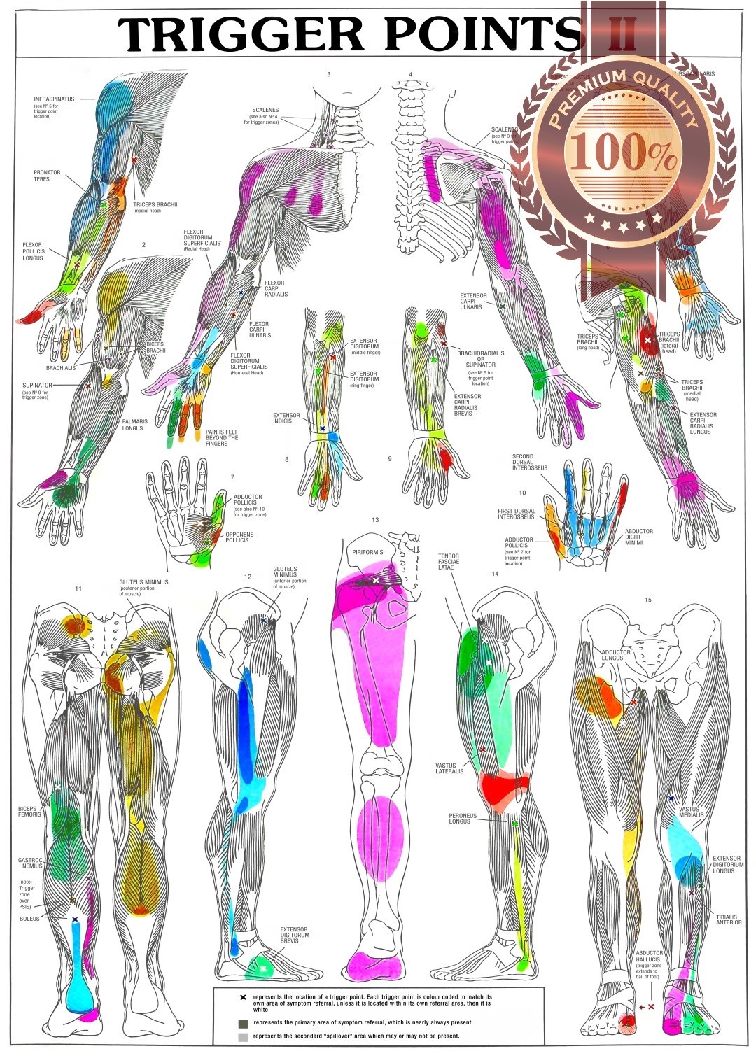 TRIGGER POINTS PART 2 ANATOMICAL DIAGRAM CHART ANATOMY PRINT PREMIUM POSTER