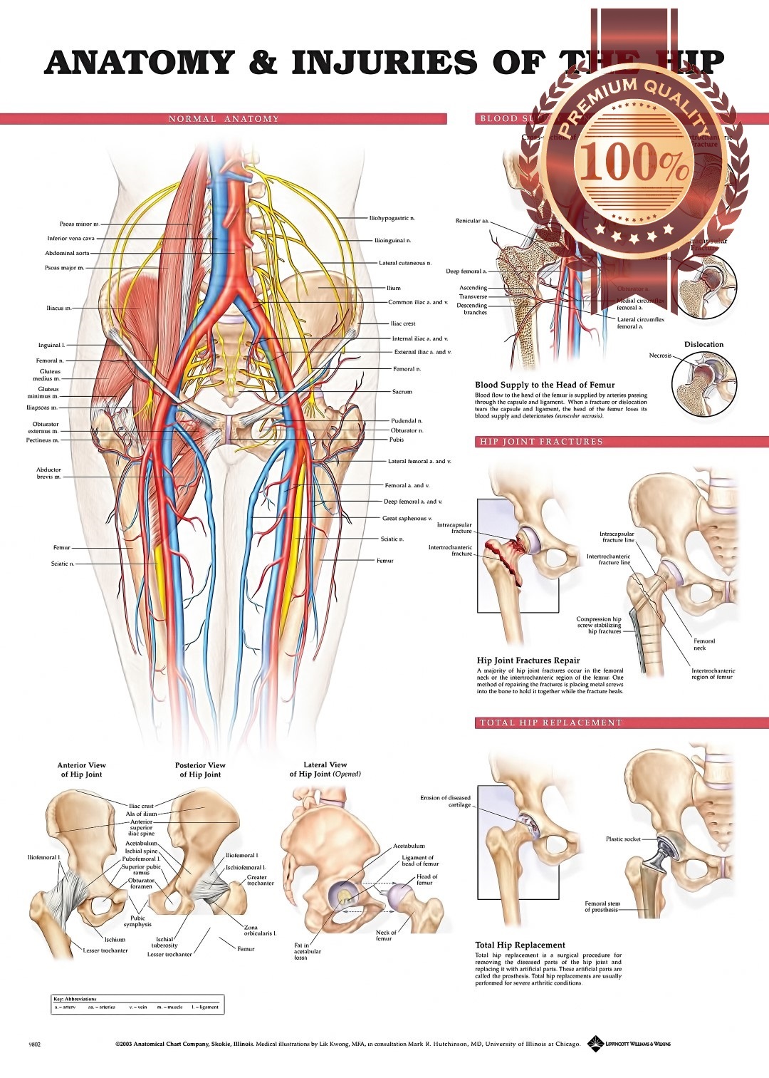 ANATOMY AND INJURIES OF THE HIPS DIAGRAM CHART GUIDE PRINT PREMIUM POSTER