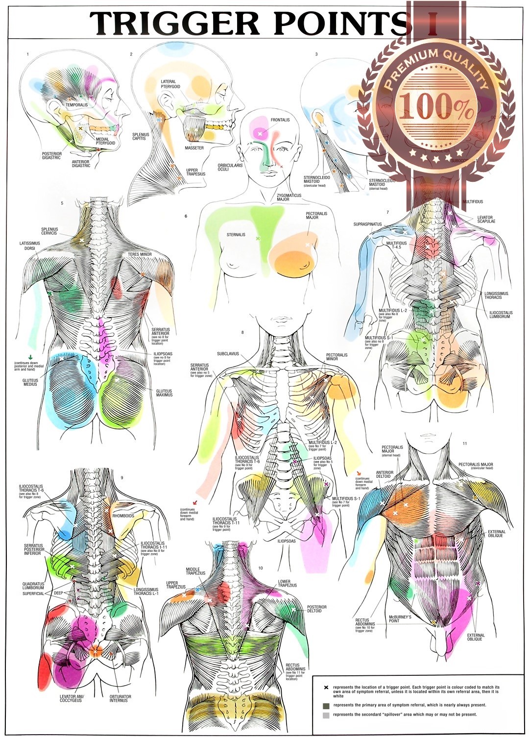 TRIGGER POINTS PART 1 ANATOMICAL DIAGRAM CHART ANATOMY PRINT PREMIUM POSTER